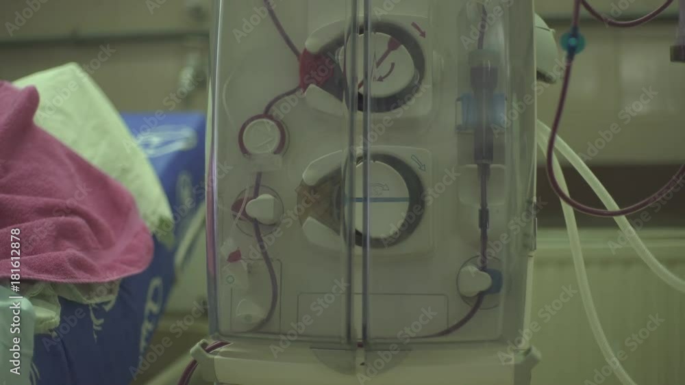 Hemodialysis machine determinates and pumps blood, tracking shot on the ...