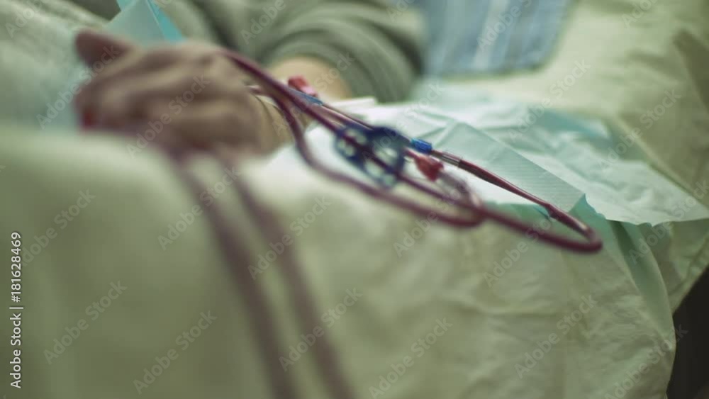 Stockvideo Focus change on the pipes injected in hand of hemodialysis ...