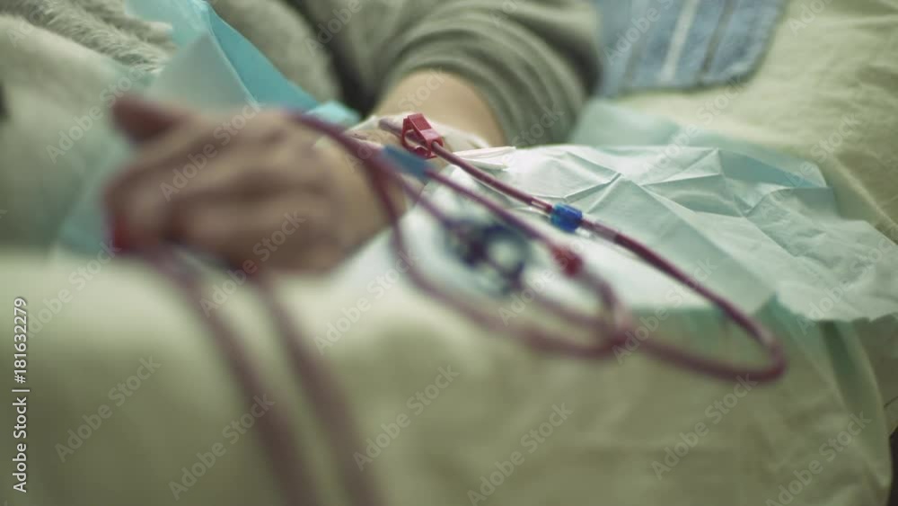 Focus change from the tube on the injected hand of hemodialysis patient ...