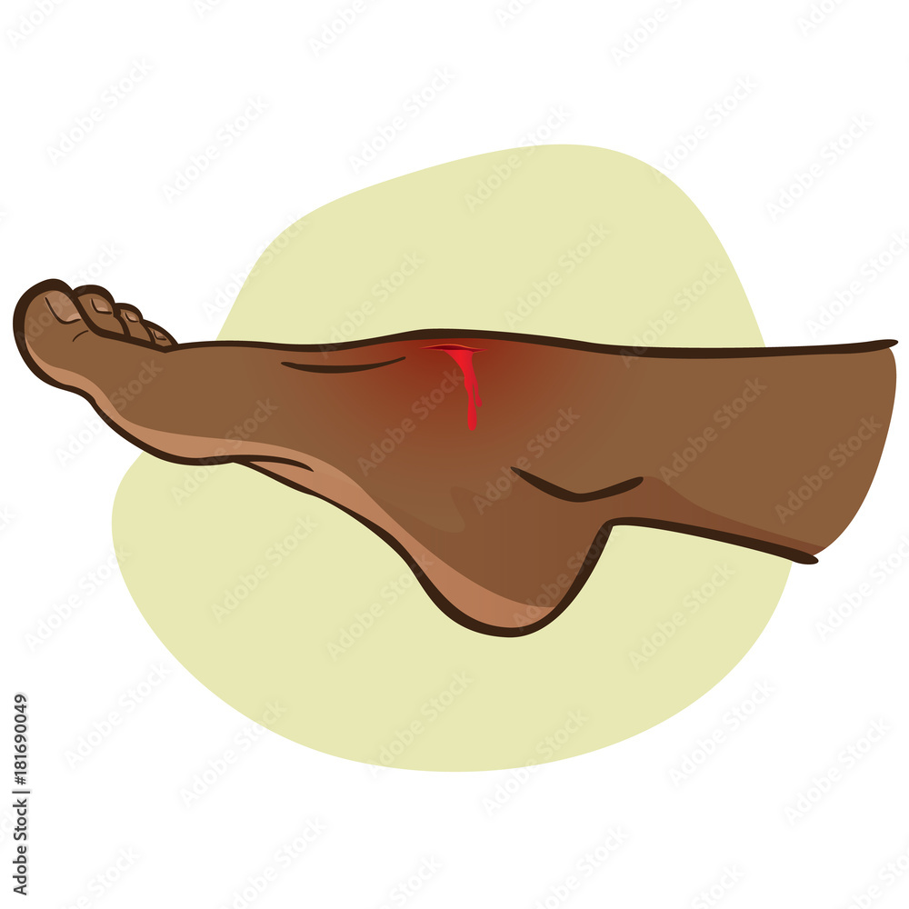 Illustration First Aid person, afro descent, standing side view, with a ...