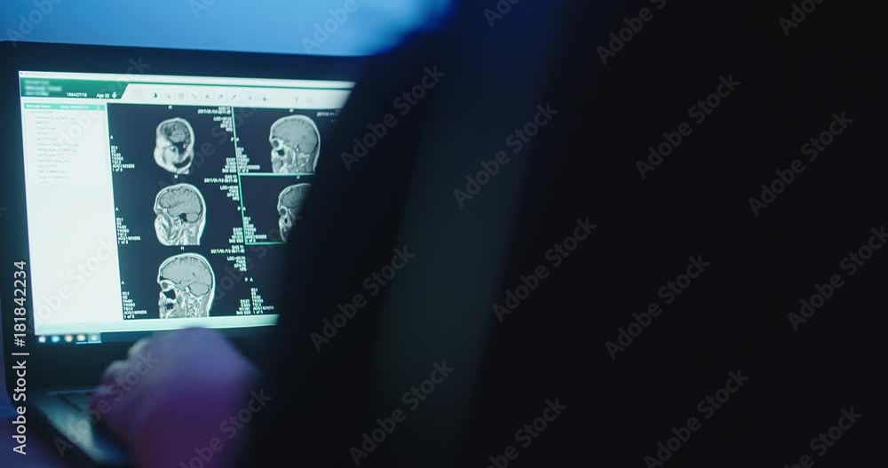 Reveal Multiple MRI Head Scans on Laptop Medium Pan Left. view pans ...