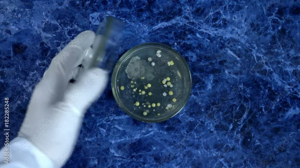 Examination of bacterial colonies on a petri dish. Staphylococcus and ...