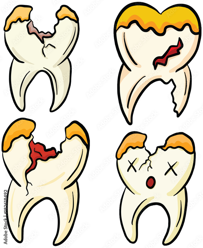 Rotten Teeth Cartoon