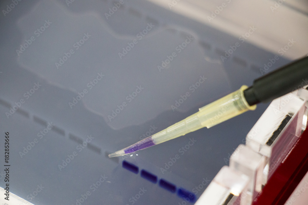Poster Agarose gel electrophoresis is a method of gel electrophoresis ...