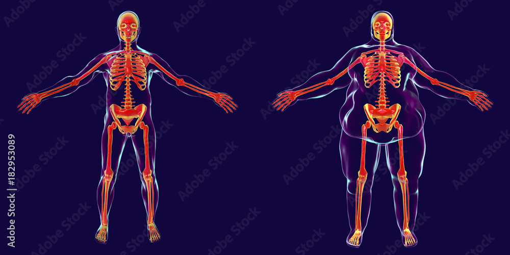 Obesity problem conceptual image, 3D illustration showing normal wieght ...