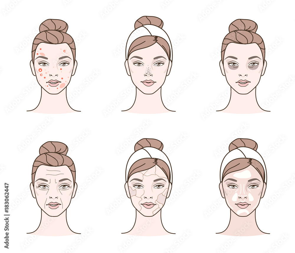 skin problems Stock Vector | Adobe Stock