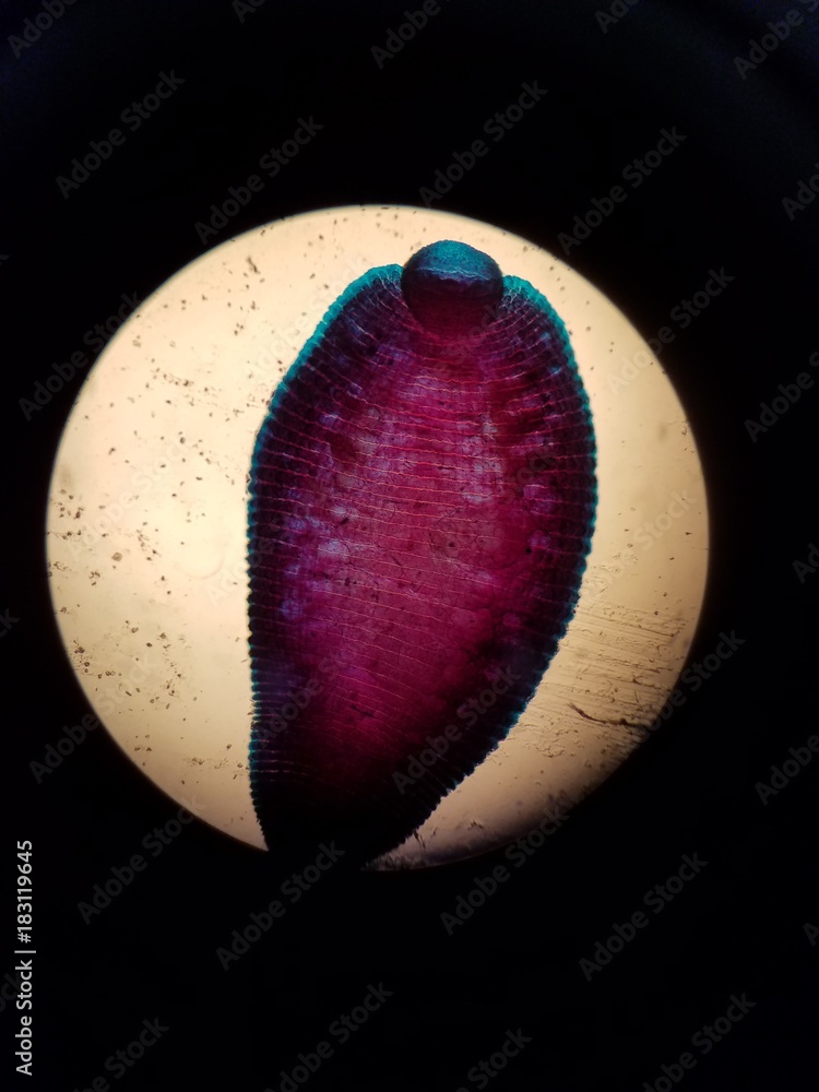 Leech under a Microscope Stock Photo | Adobe Stock