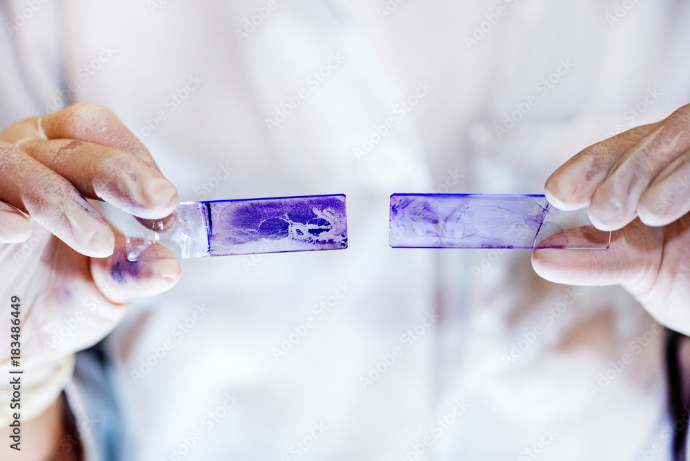 Microbiology laboratory work, comparing results Stock Photo | Adobe Stock