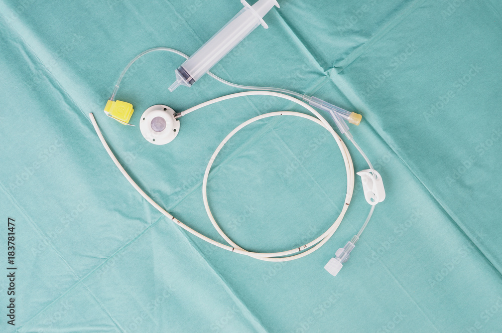 Port a catheter inserted at chest wall and needle Stock Photo | Adobe Stock