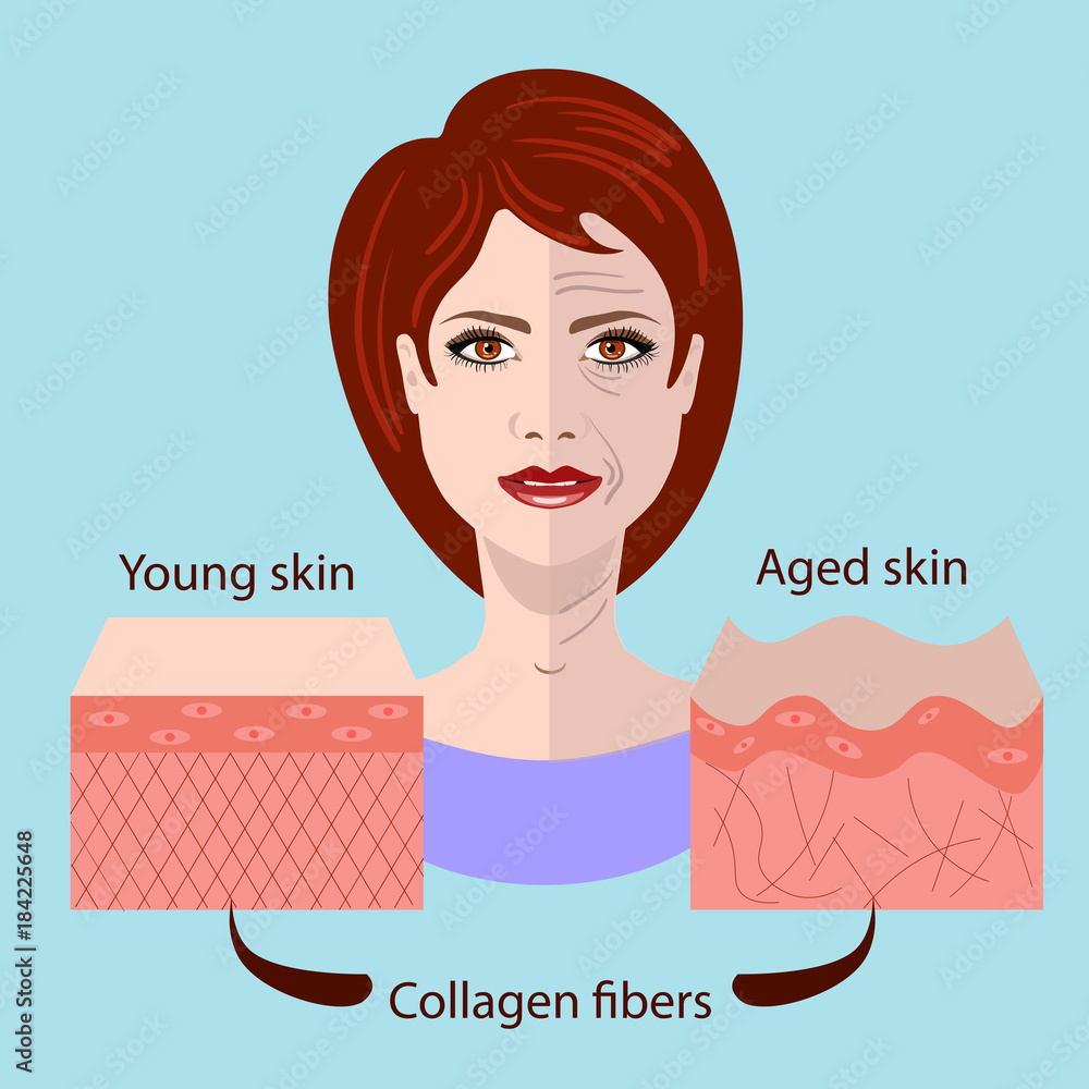 Vector face and two types of skin - aged and young for medical and ...