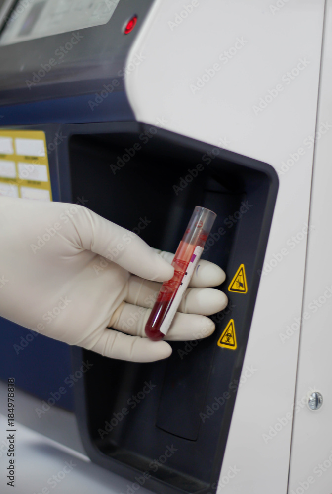 Scientists tested with automated hematology analysis in laboratory ...