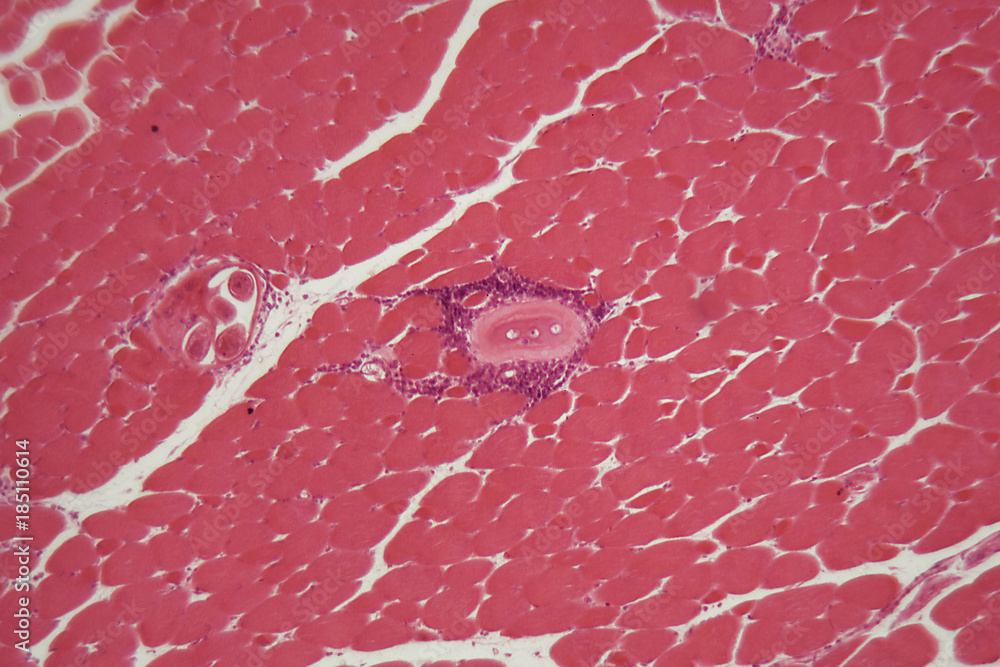 Trichinella spiralis larvae in muscle tissue under the microscope ...