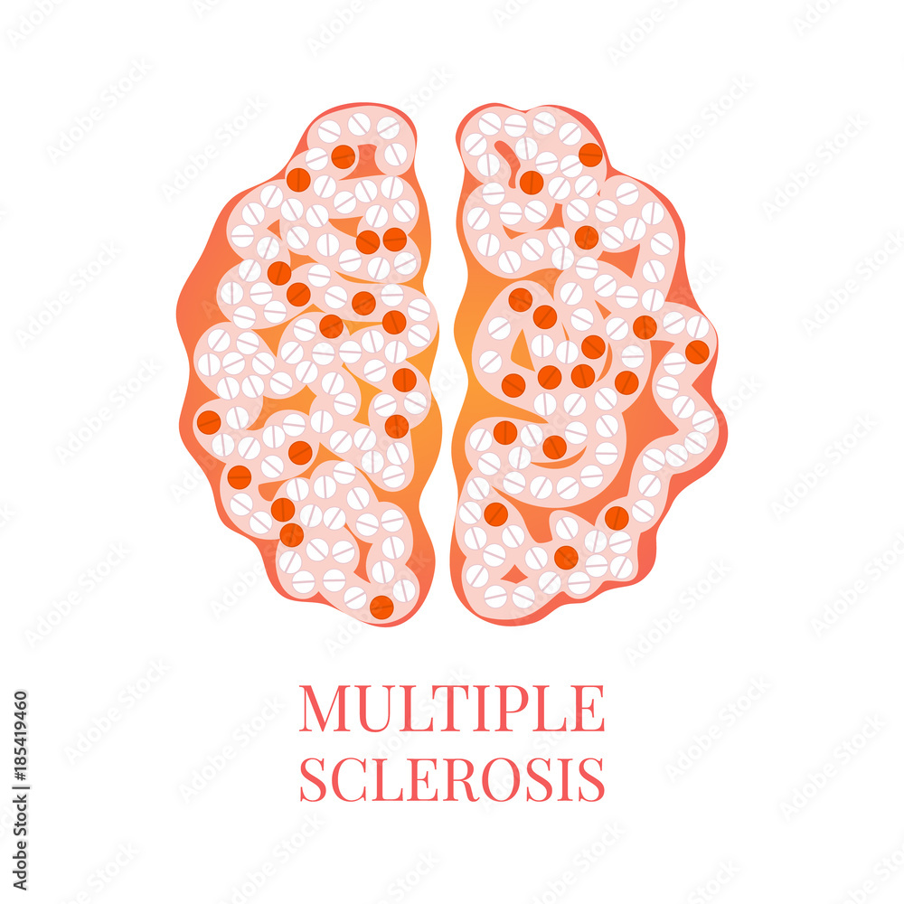 Multiple sclerosis awareness poster with brain made of pills on white ...