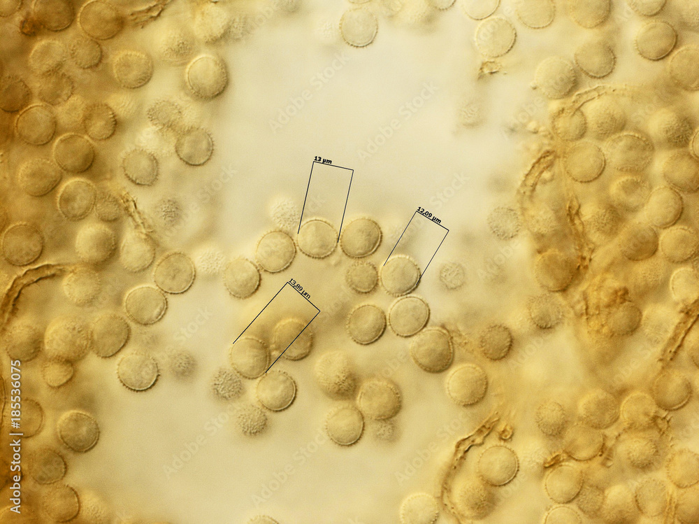Slime Molds Microscope