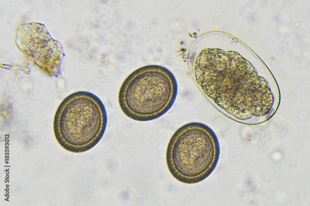 Hookworm Eggs In Stool