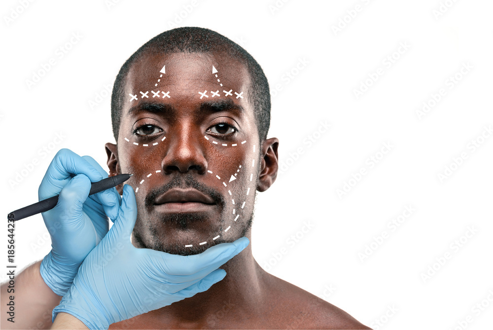 Surgeon drawing marks on male face against gray background. Plastic ...