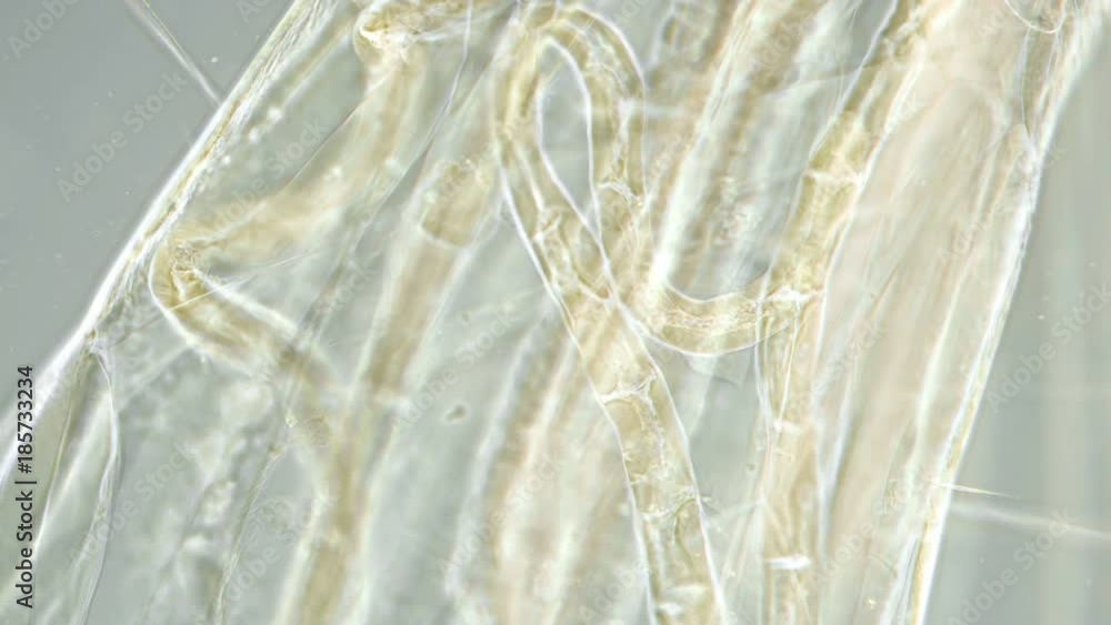 a transparent larva under the microscope,with internal organs,like an ...