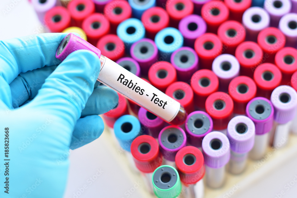 Blood sample for rabies virus test Stock Photo | Adobe Stock