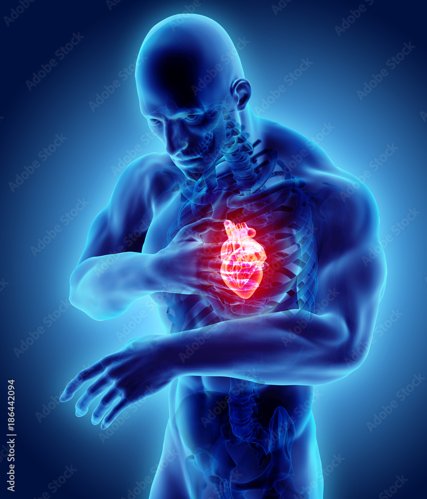 3d illustration of human heart attack. Stock Illustration | Adobe Stock