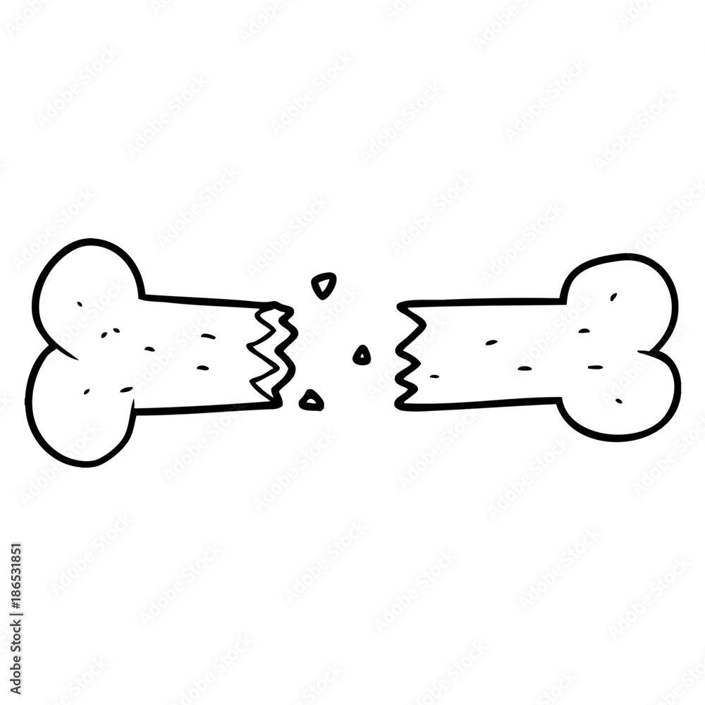 broken bone cartoon Stock Vector | Adobe Stock