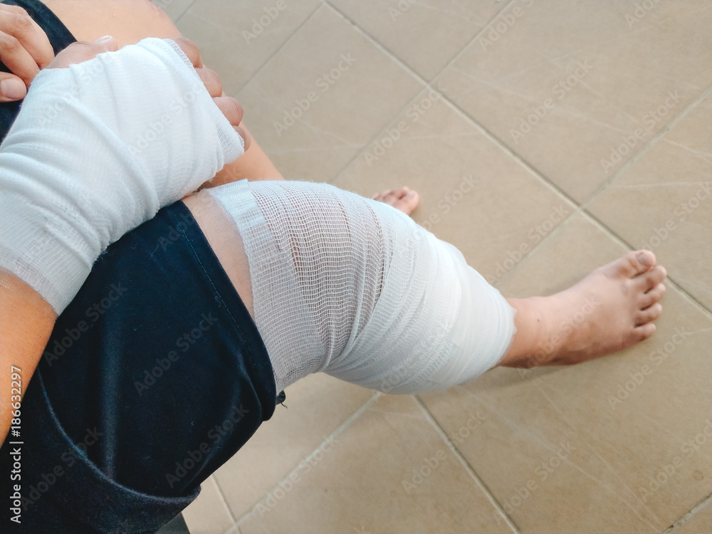 health care background man accident arm and leg with bandage. image for ...