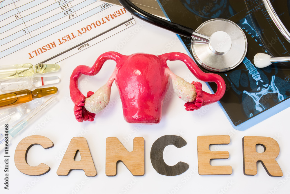 Uterus cancer concept. Anatomical shape of uterus with ovaries lies ...