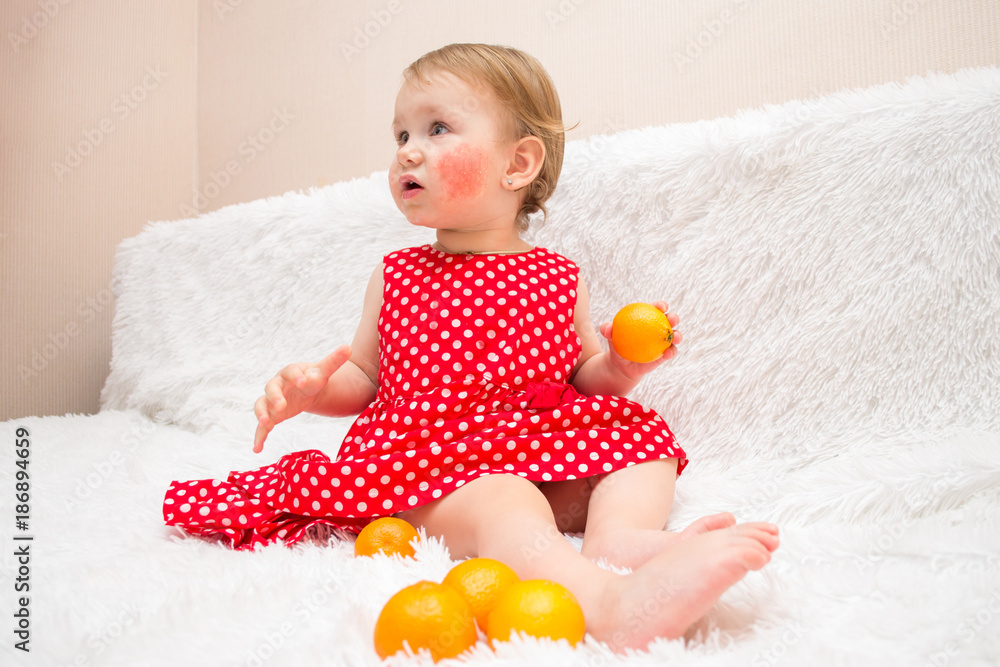 Foto de beautiful baby girl in a dress with an allergic rash on her ...