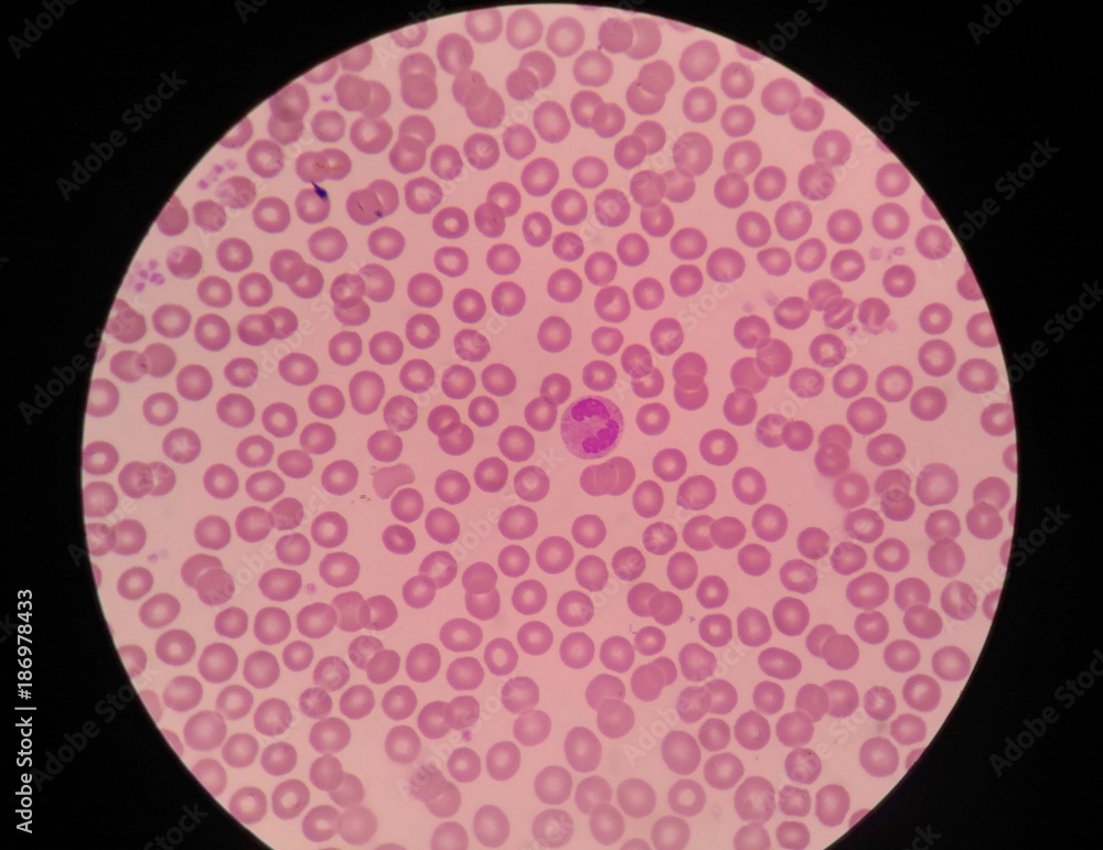 red blood cells medical science background. Stock Photo | Adobe Stock