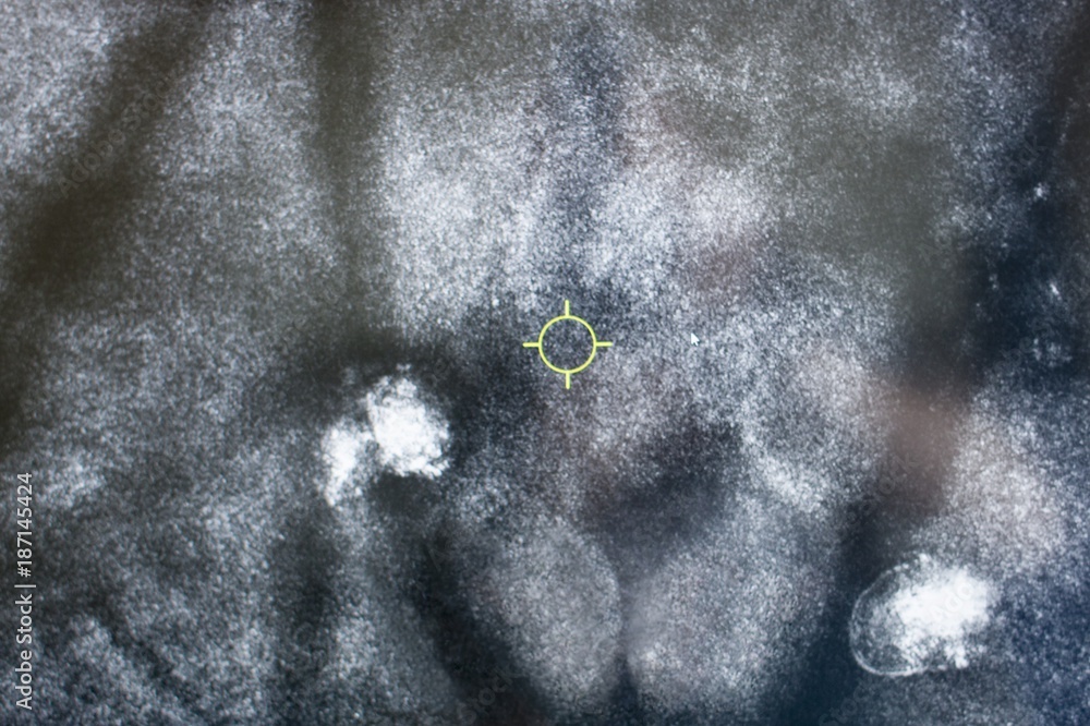 Computer monitor used in skin clinic Stock Photo | Adobe Stock