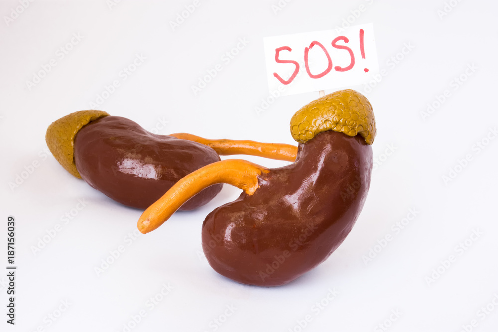 Natural anatomical 3D kidneys model with placard inscripted SOS ...