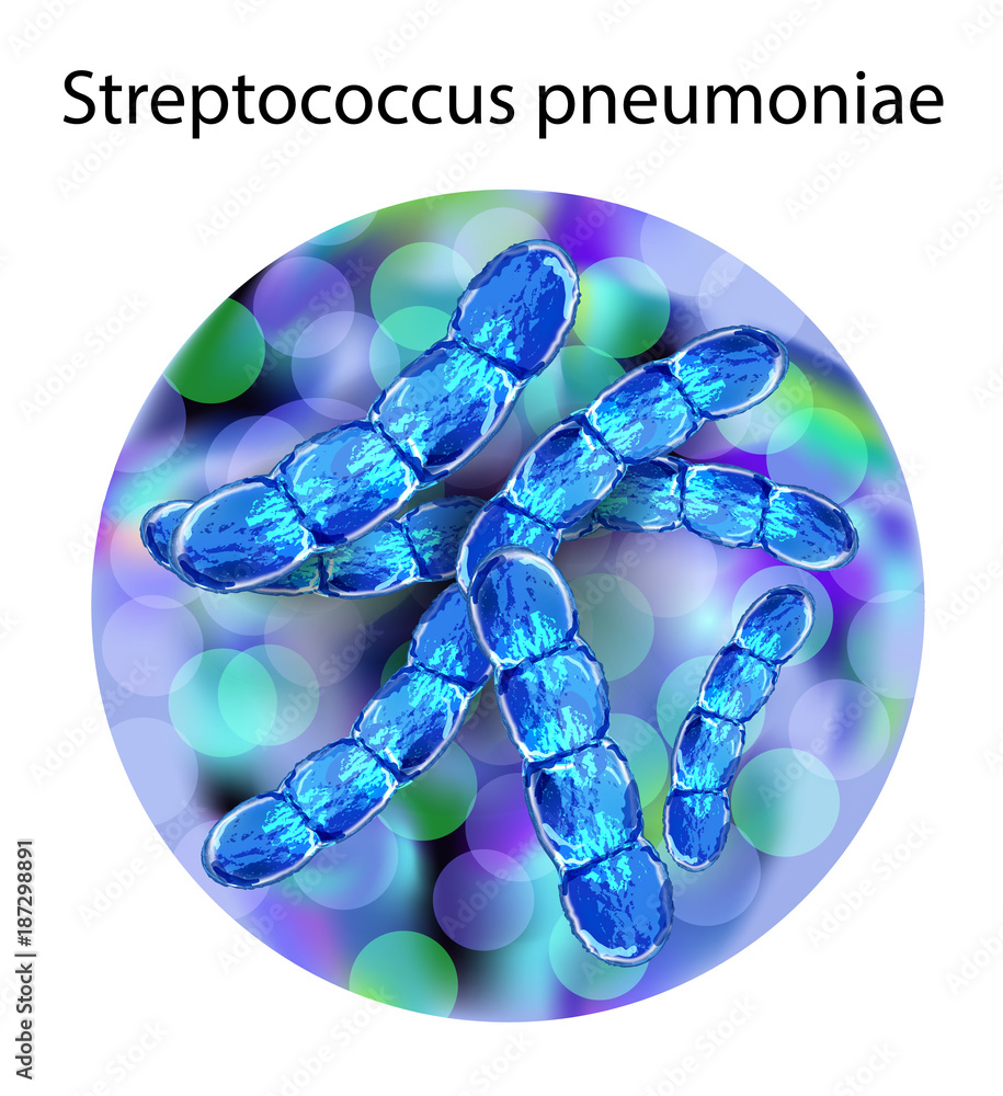 Streptococcus pneumoniae, or pneumococcus. Stock Vector | Adobe Stock