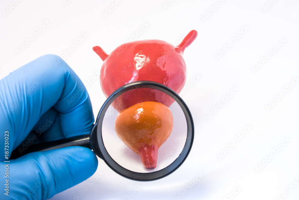 Examination by doctor urologist of prostate gland photo concept. Doctor ...