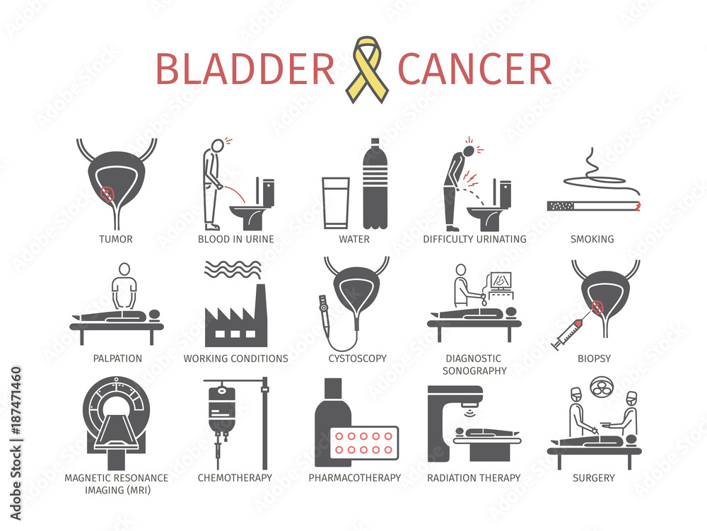 Bladder Cancer. Symptoms, Causes, Treatment. Flat icons set. Vector ...