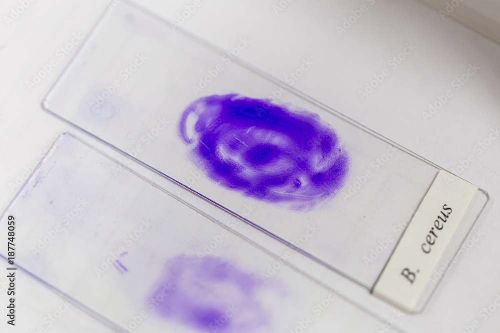 Smear In Microbiology