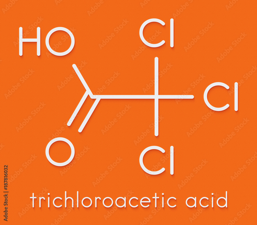 Trichloroacetic acid (TCA) molecule. Used in dermatological treatment ...