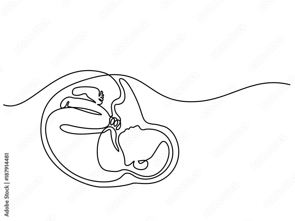 Continuous line drawing. Baby in womb on the white background. Vector ...