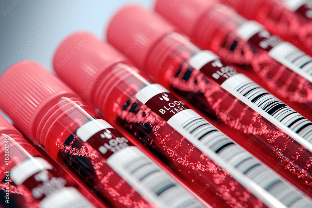 Molecule of DNA forming inside the test tube in the blood test ...