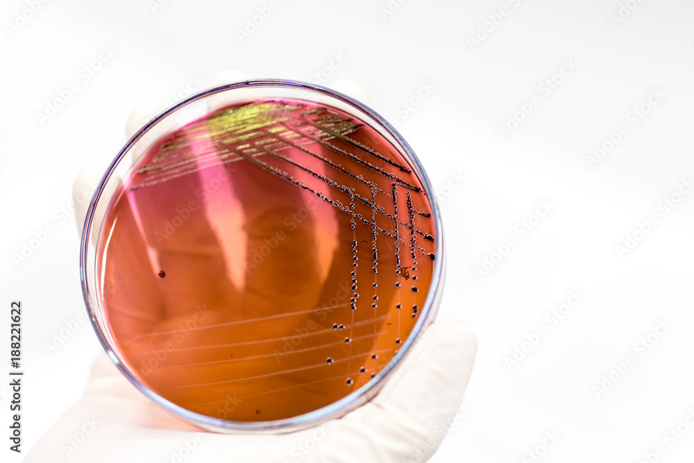 Colony Characteristics of Escherichia coli (E. coli) is a Gram-negative ...