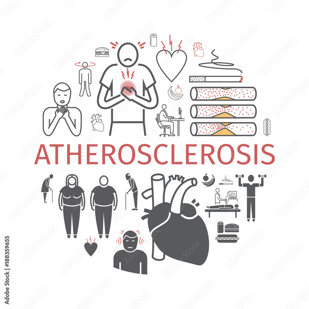 Atherosclerosis banner. Symptoms, Treatment. Line icons set. Vector ...