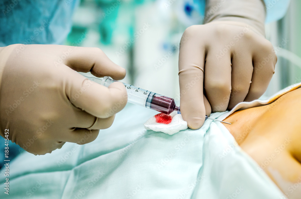 Setting a central venous catheter to the patient before surgery. Stock ...