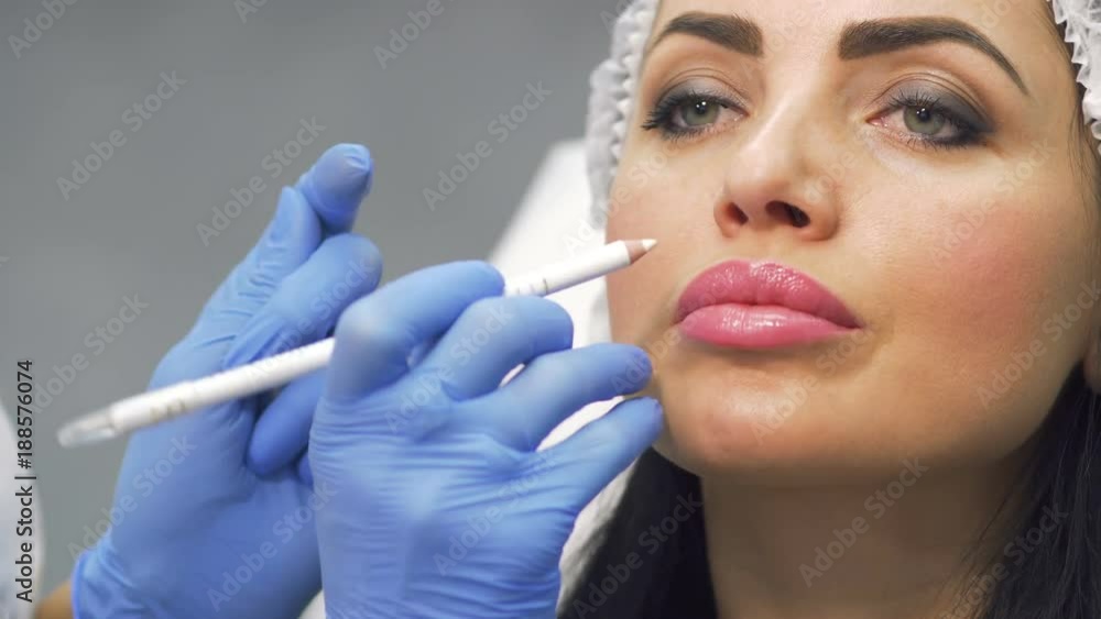 Doctor marks facial zones for botox procedure vídeo de Stock | Adobe Stock