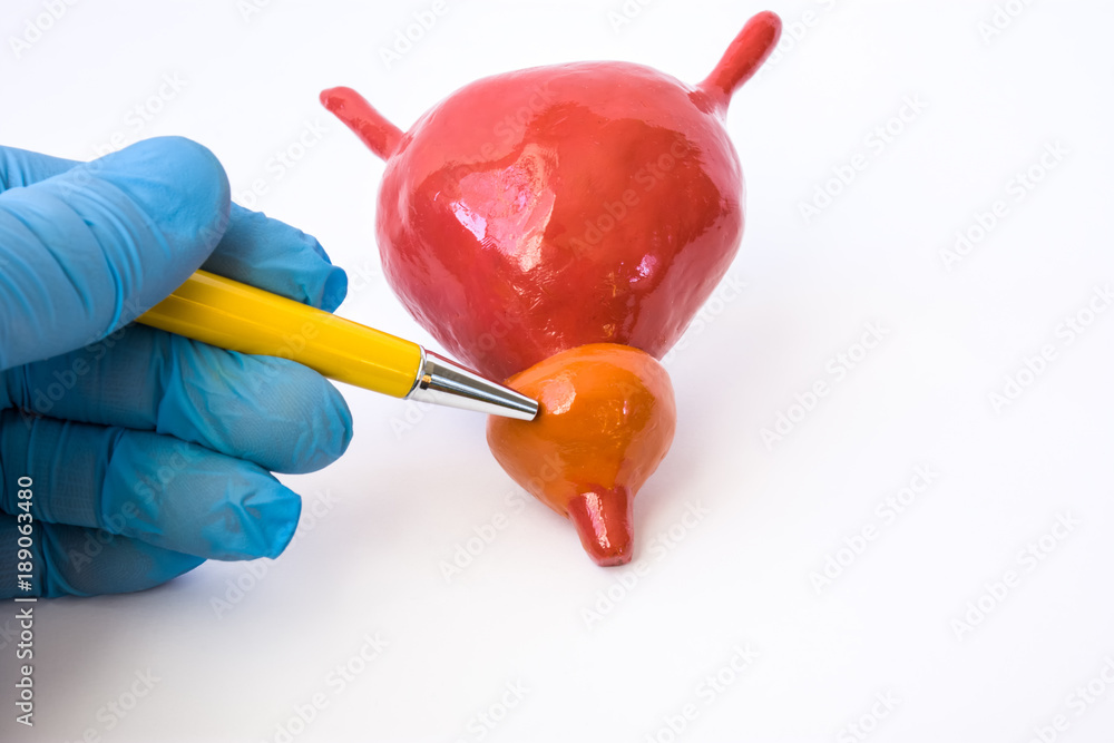 Doctor or teacher with ballpoint pen pointing on prostate gland on ...