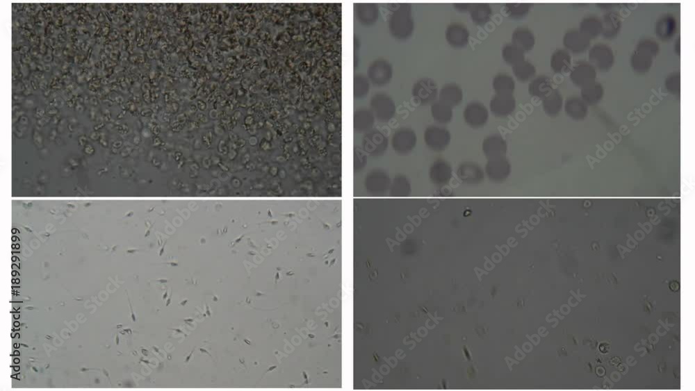 montage blood smear , parasite , human sperm under microscope vídeo de ...
