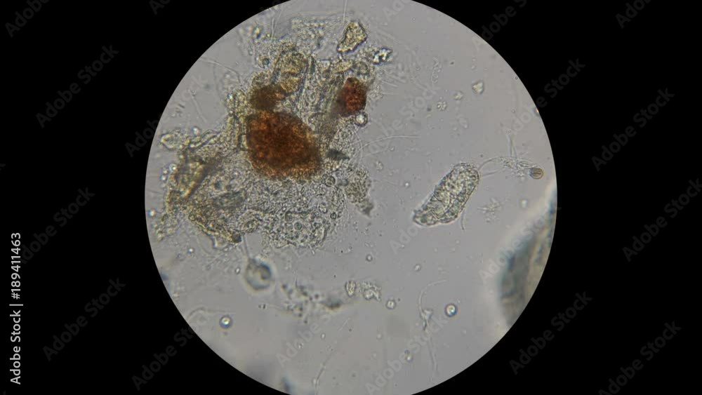 microorganisms,the inhabitants of the aquarium under the microscope ...