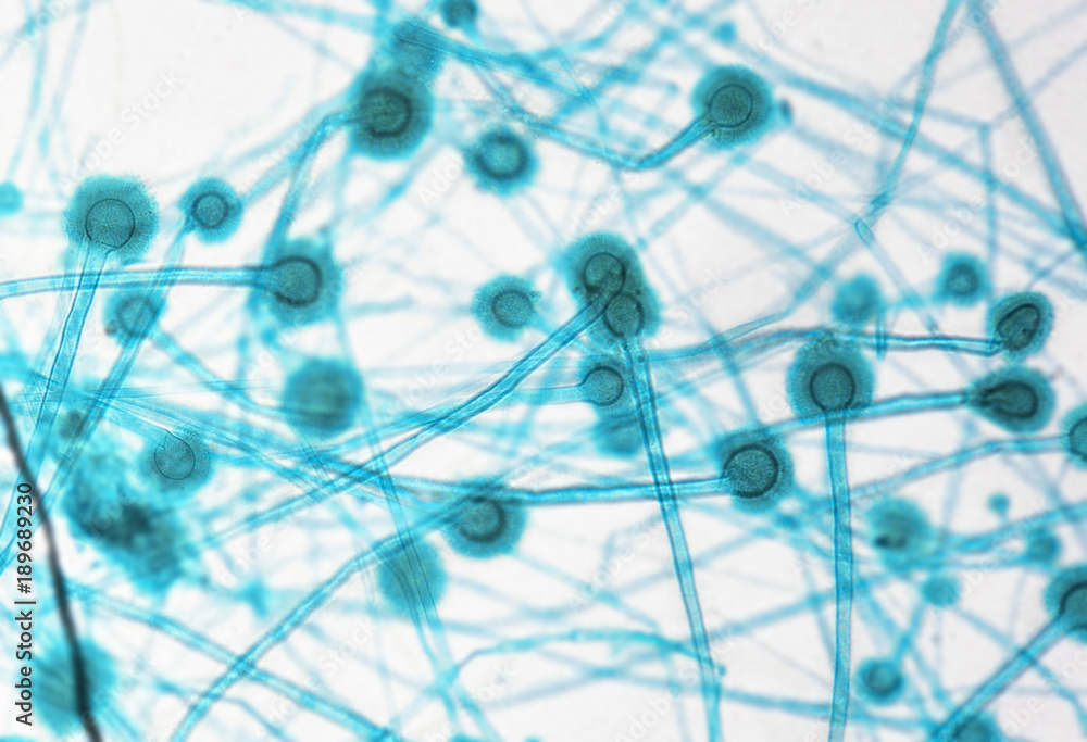 Aspergillus Under Microscope