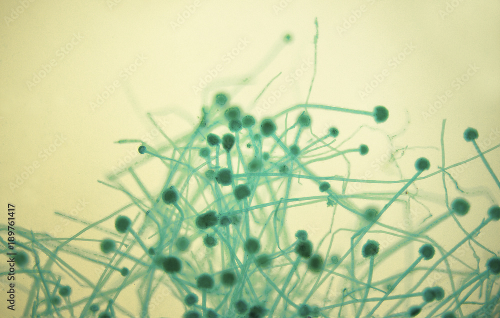 Aspergillus Slide Labeled