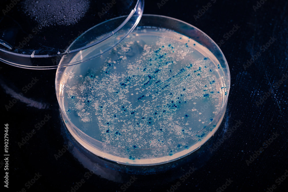 colonies in petri dish for cloning of transgenic vector into plasmid ...