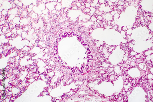 Cross-section of human lung tissue showing bronchiole and alveoli ...