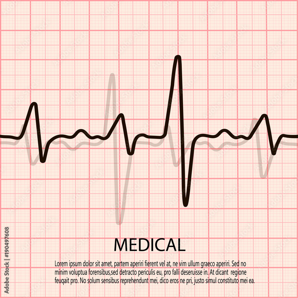 Cardiology concept with pulse rate diagram. Medical background with ...