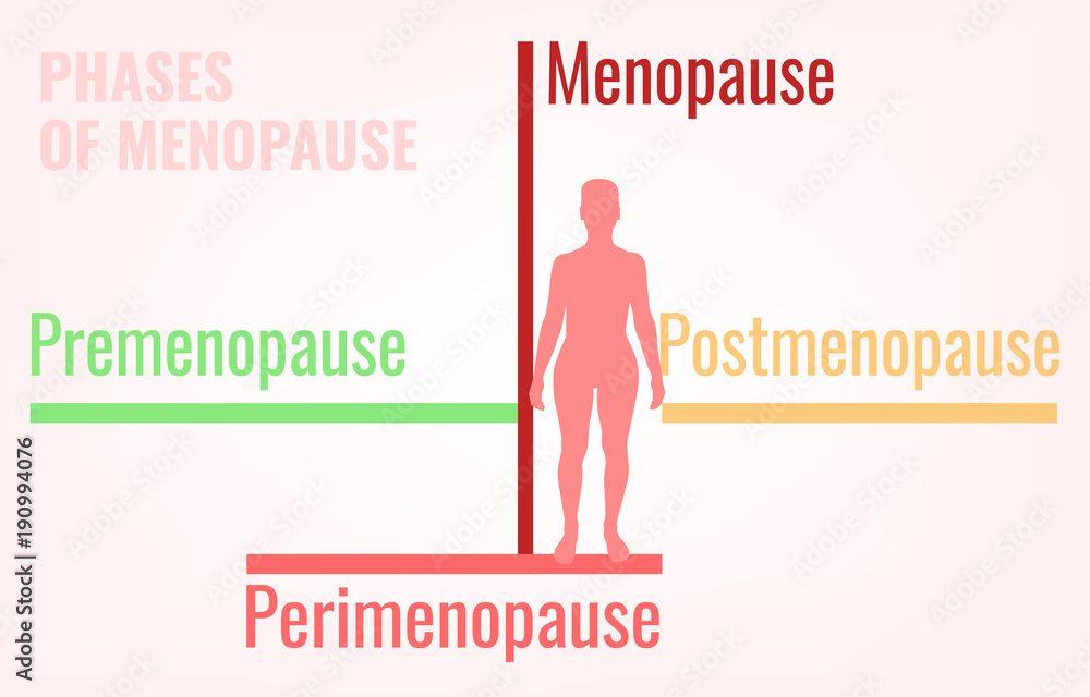 Stages of Menopause Infographic Stock Vector | Adobe Stock